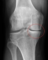 Behandelingen • OrthoCareClinics