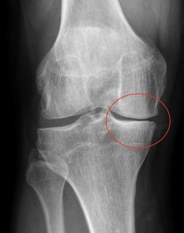 Behandelingen • OrthoCareClinics