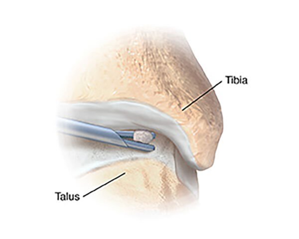 Behandelingen • OrthoCareClinics